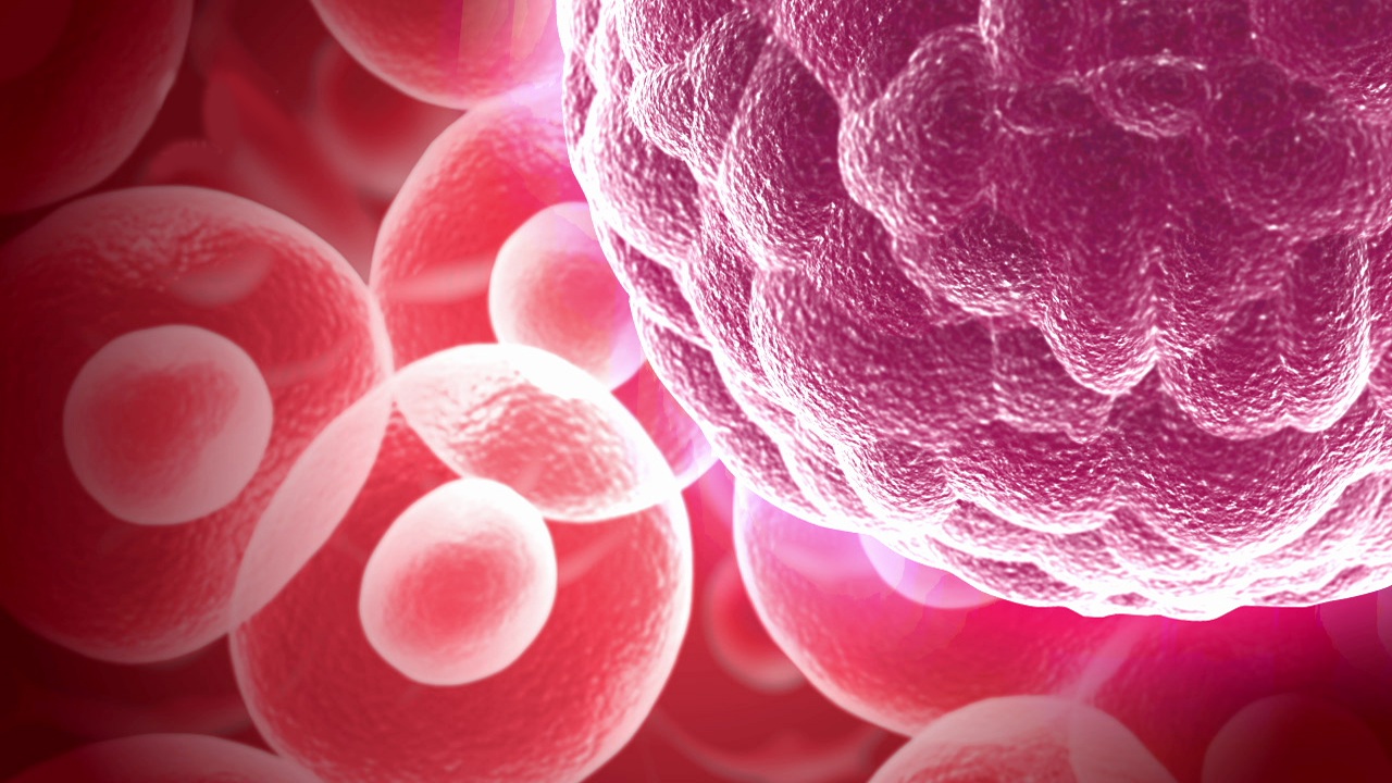 A Review Of Colorectal Cancer Formation, Metastasis And Gene-therapy ...